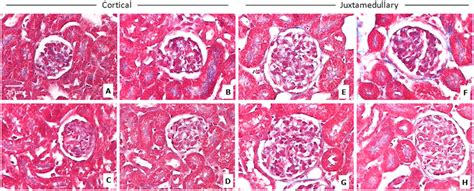Masson´s Trichrome Staining Of The Renal Cortex Representative Images