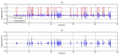Extraction Of Ehg Contractions A Ehg Signal And Segmentation Limits Download Scientific