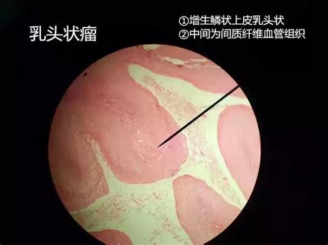 病理学 组织切片 总结（知识点总结 重点笔记 期末重点归纳整理 题库 思维导图 名词解释 简答题 网课 怎么学 电子版pdf） 知乎