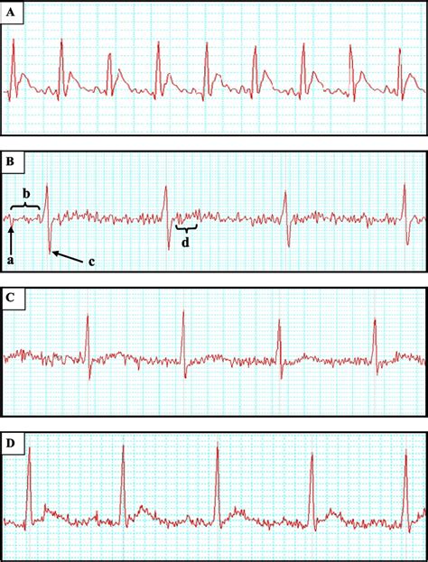 Qualitative Analysis Of Ecg Of All The Experimental Groups N 6 A Download Scientific Diagram