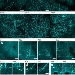 In Vivo Imaging Of Mouse Cortex Using Spectral Confocal Reflectance