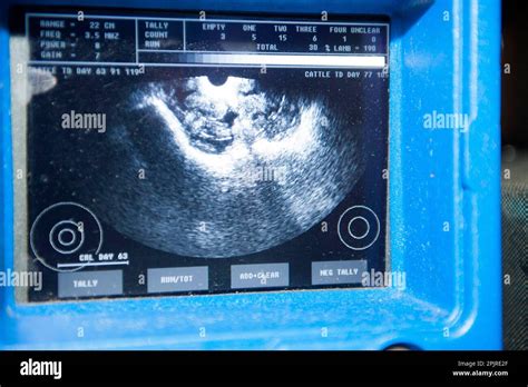 Sheep Farming Ultrasound Scanner Screen Scanning Ewes During Early