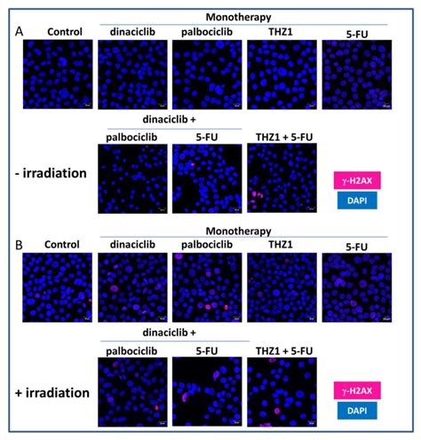 γ H2AX staining of UT SCC 14 cells In order to detect a potential
