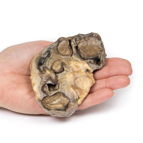 Pyonephrosis Australian Physiotherapy Equipment