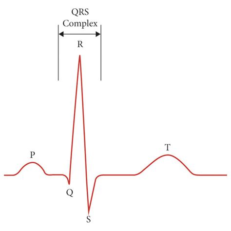 Flow Chart Of Ecg Signal Preprocessing Download Scientific Diagram