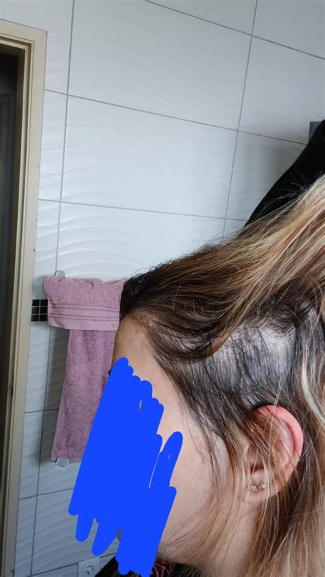 Any Hope For Ridiculously Thin Hair Rhair