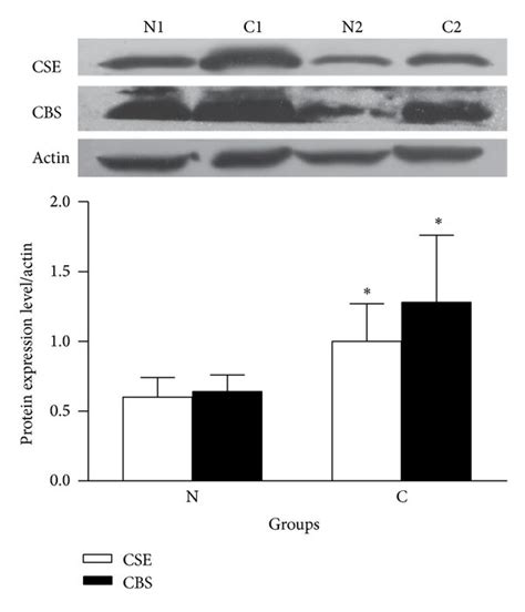 Upregulation Of Cse And Cbs Expression In Gastric Carcinoma A Tissue