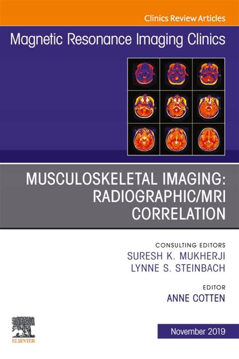 Musculoskeletal Imaging Radiographicmri Correlat 12996246863