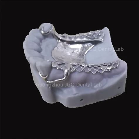 Customized Metal Framework Make Of Cobalt Chromium Alloy Or Pure Titanium With High Strength