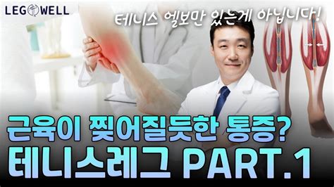 근육이 찢어지는 통증 테니스레그 종아리 알이 너무 튀어나왔다면 이 영상 꼭 보세요 테니스엘보만 있는게 아닙니다 강남 하지