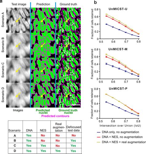 Combination Of Nes And Real Image Augmentations On Segmentation