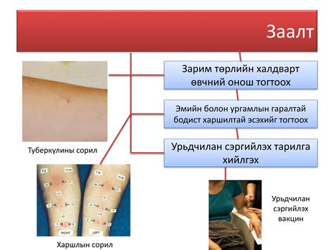 Арьсан доторх тарилга Pptx