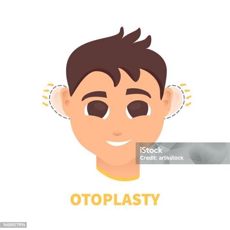 Otoplasty 귀 수술 치료 전후의 남자 가공의 인물에 대한 스톡 벡터 아트 및 기타 이미지 가공의 인물 감소 개선