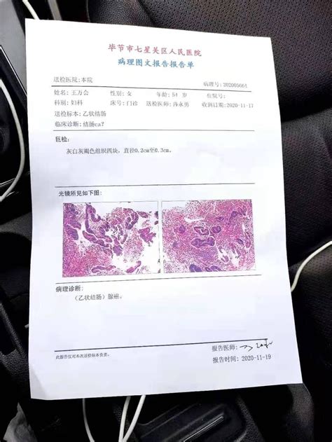 直肠癌晚期真的没希望了吗 知乎