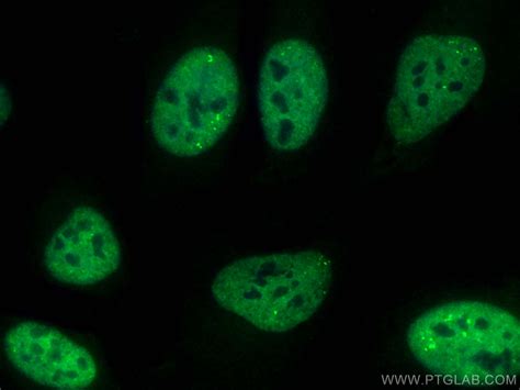 Tdp 43 C Terminal Antibody Cl488 81350 Proteintech