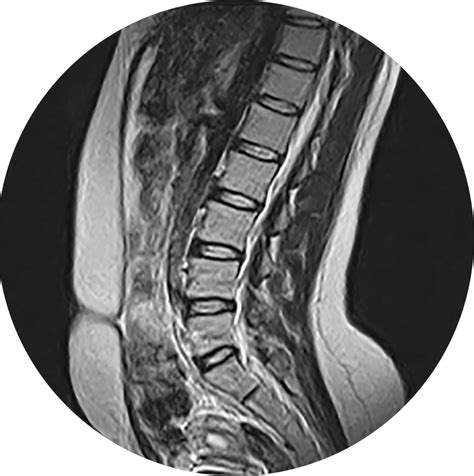 ام آر آی چیست و چرا استفاده می شود؟ مرکز تصویربرداری پزشکی دکتر قائمیان
