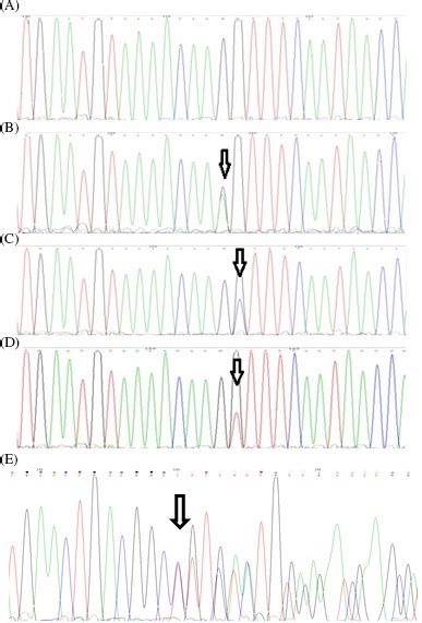 Chromatograms Presenting Some Of The Exon2‐med12 Somatic Mutations A