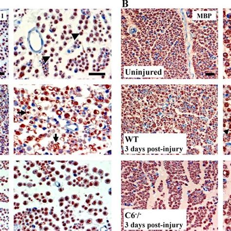 Hemolytic Assay Complement Dependent Hemolysis In Serum From Wt