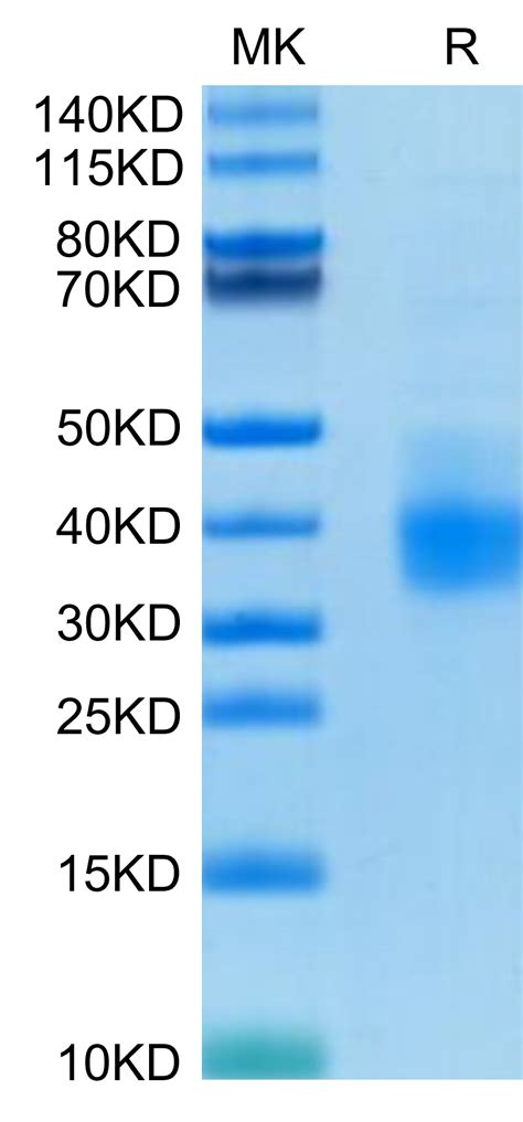 Recombinant Human Pd L1b7 H1 Protein Active High Quality Beta