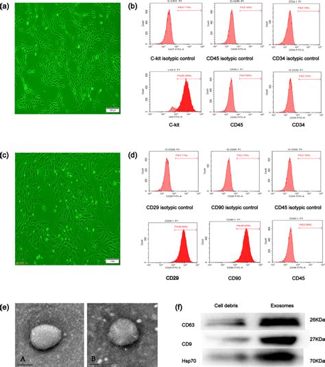 Characterization Of C Kit Cscs Mscs And Exosomes A Phase