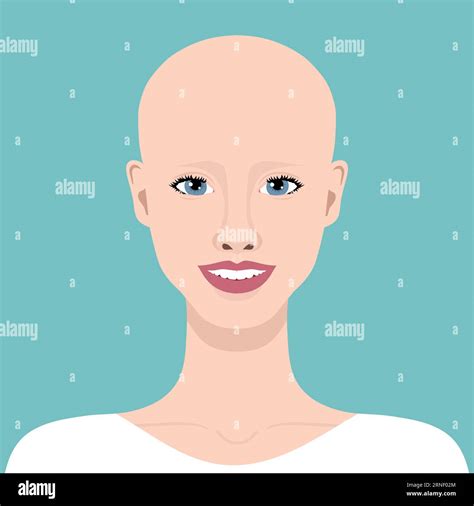 Young Smiling Woman With Alopecia Beautiful Bald Girl Alopecia Areata