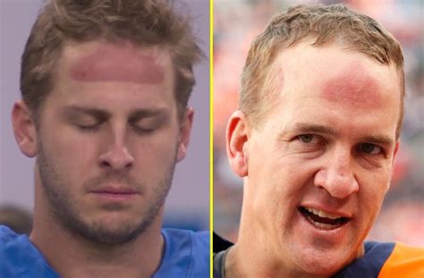 Forehead Peyton Manning