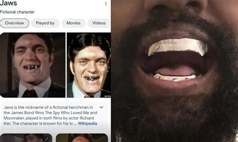 Kanye West Se Implanta Dentadura De Titanio Inspirada En Tiburón Cuánto Gastó
