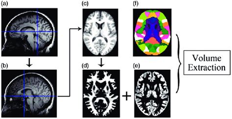 Imaging Processing Steps Download Scientific Diagram