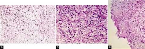 Surgical Neurology International