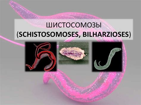 Schistosomoses Bilharzioses