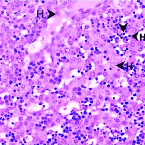 Photomicrograph Of Ts Of 15 Weeks Human Fetal Liver Showing Capsule