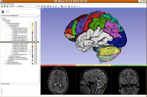 dicom image viewers weixin 30745553的博客 csdn博客