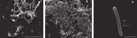Scanning Electron Microscopy Sem Showing Clostridioides Difficile Download Scientific Diagram
