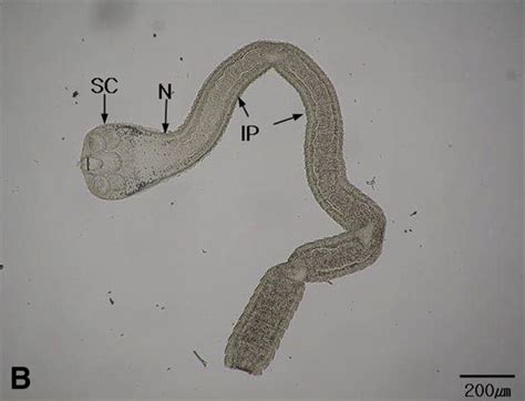 Hymenolepis Nana Habitat Morphology Life Cycle