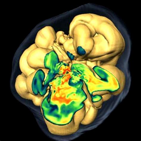 Supernova Core Collapse Simulated In 3d
