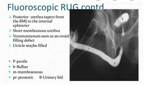 A Retrograde Delhi Radiologic Technologist Group Facebook