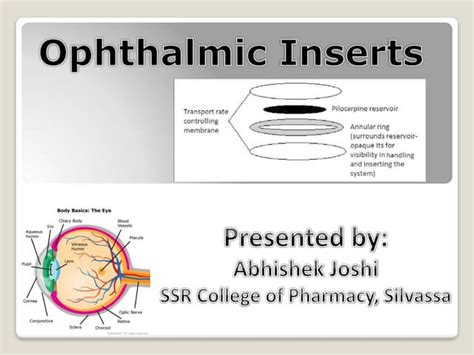 Ocuserts [ocular Inserts] Pptx