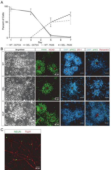 Figures And Data In 16p11 2 Microdeletion Imparts Transcriptional