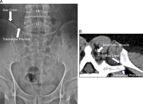 American Journal Of Physical Medicine And Rehabilitation