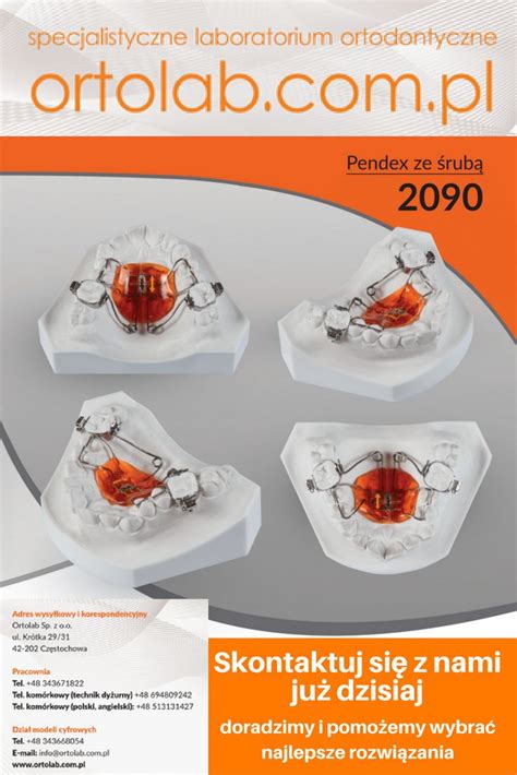 Pendex Ze śrubą Pendulum Appliance Inserted Ortlab Ortodoncja