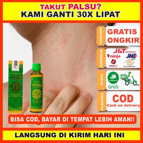 Jual Obat Ruam Pada Kulit Gatal Merah Kaligata SAPU JAGAT MINYAK