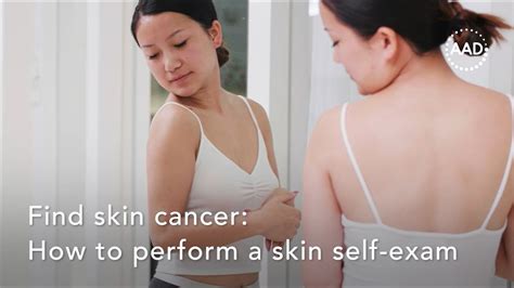 Find Skin Cancer How To Perform A Skin Self Exam Youtube