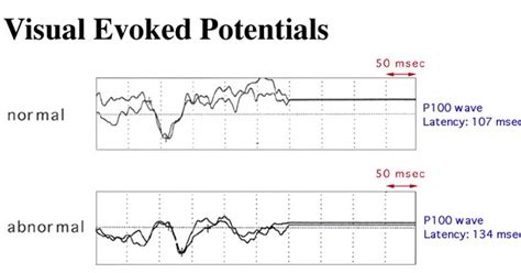 Journal And Conferences On Biomedical Engineering Enhancing Visual