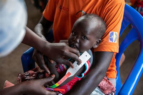 Face à la malnutrition aiguë qui menace la vie de millions denfants