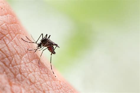 How To Get Rid Of Bug Bites Headassistance3