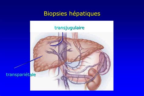 PPT Sémiologie du foie et des voies biliaires PowerPoint Presentation ID