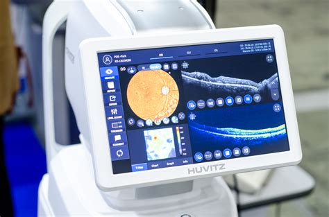 Innovative AI Model Detects Retinal Disease In Infants DailyAI