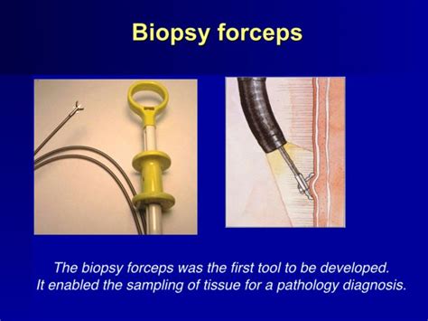 History Of Endoscopy Endovision