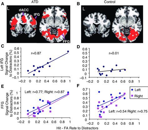 brain activation maps regions where activations were significantly download scientific diagram