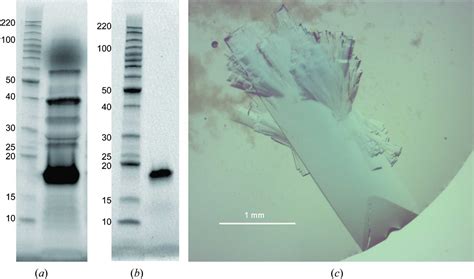 Iucr Neutron And High Resolution Room Temperature X Ray Data Collection From Crystallized